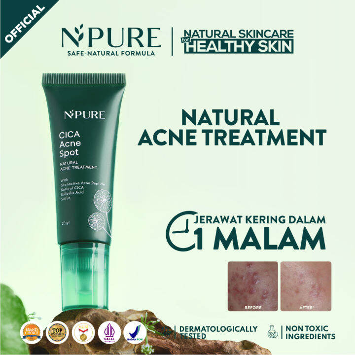 NPURE Acne Spot Cica / Obat Totol Jerawat Breakout / Acne Treatment ...