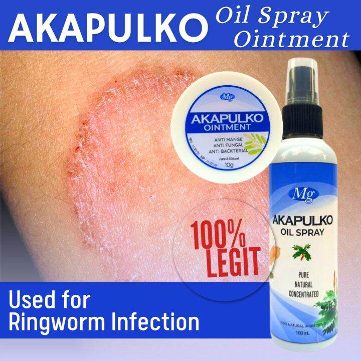MG AKAPULKO OIL SPRAY 100ML & OINTMENT 10G Herbal Antibacterial Firming ...