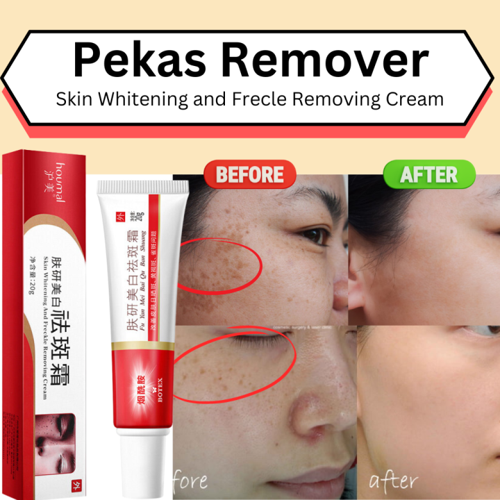Authentic Melasma Pekas Remover Cream Collagen Pekas Remover Original ...