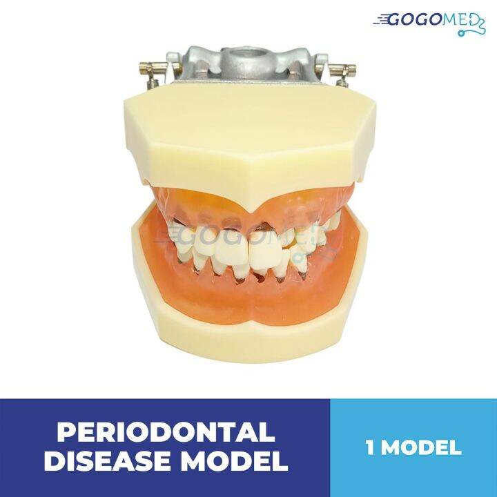 Periodontal Model 1 Model Perio Typo Jaw | Lazada PH
