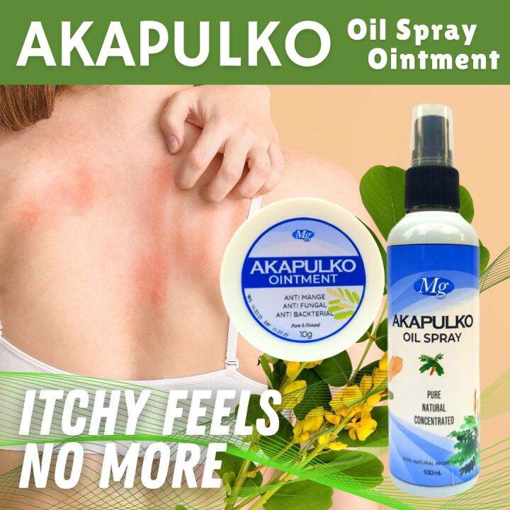 MG AKAPULKO OIL SPRAY 100ML & OINTMENT 10G Anti-Fungal Herbal Gel ...