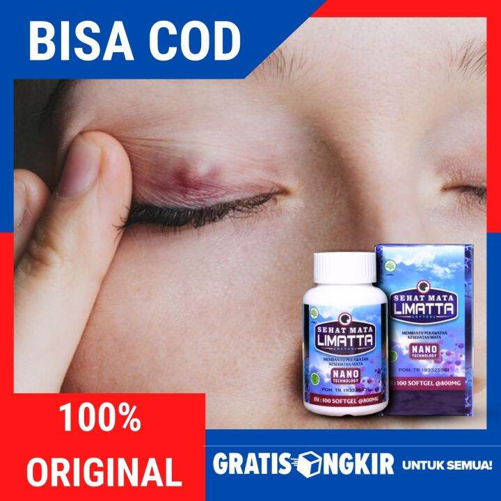 Obat Kalazion - Obat Benjolan Di Kelopak Mata - Mata Bengkak - Iritasi ...