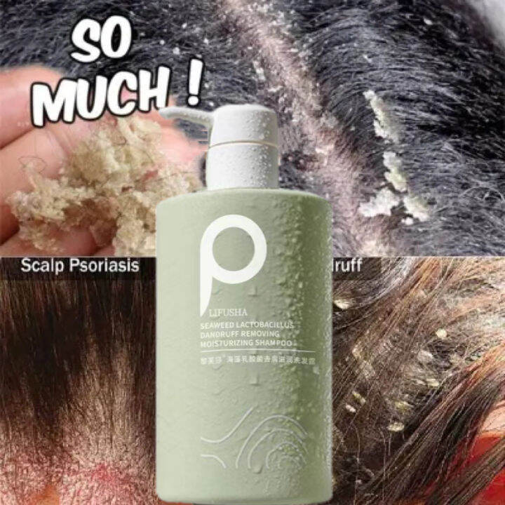 Sampo garam laut sampo sampo anti gatal 500ml anti gatal anti ketombe, pengobatan folikulitis ...