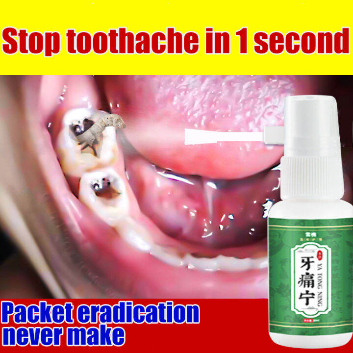 Toothache Ning spray on fire moth tooth pain water toothache spray ...
