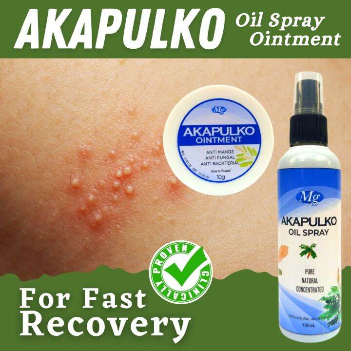 MG AKAPULKO OIL SPRAY 100ML & OINTMENT 10G Herbal Rashes Cream: Anti ...
