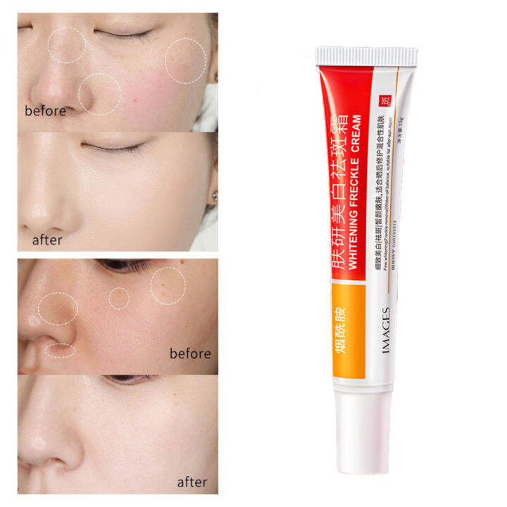 Dark Spot Corrector Cream Whitening Freckle Cream Powerful Removing Melasma Melanin Dark Spots ...