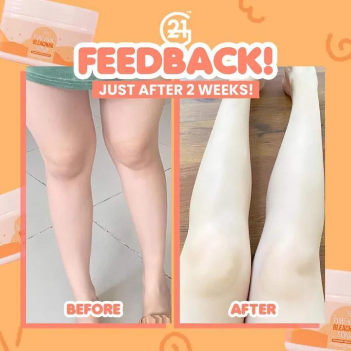 G21 Pure Kojic Bleaching Scrub 250g Whitening Body Bleaching Scrub ...