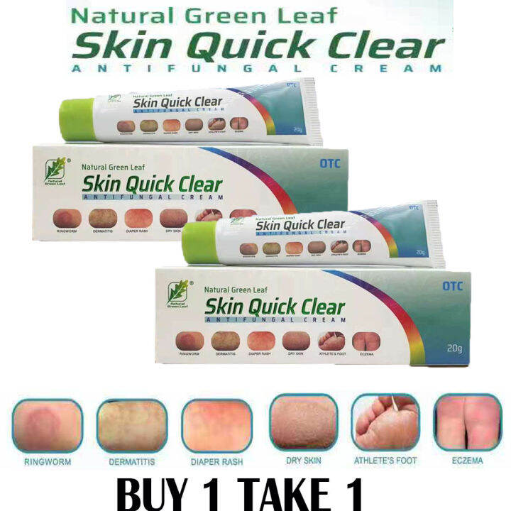 Natural Green Leaf Skin Quick Clear Antifungal Cream 15g | Lazada PH