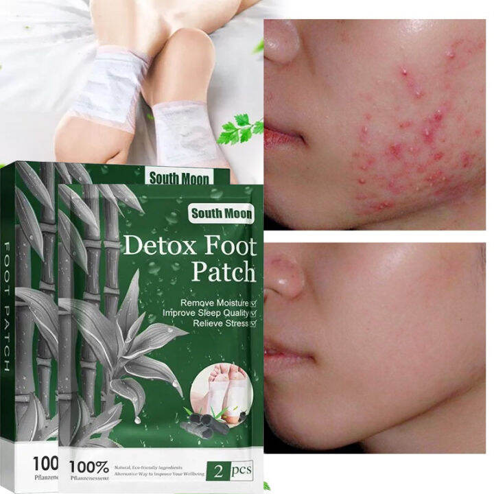 Detox Foot Patch Body Detoxify Stress Relief Rapid Foot Care and Pain ...