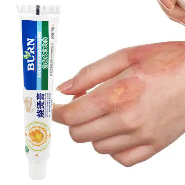 20g Scald Burn Cream Pain Relief Anti-infection Bacteriostatic ...