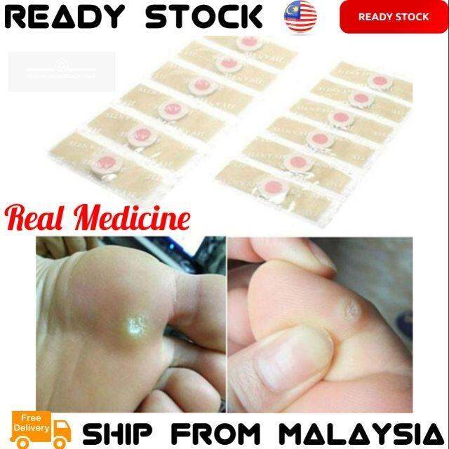 Ji Yan Tie Paste Foot Corn Plasters [ Remove The Corns ] Paste Clavus ...