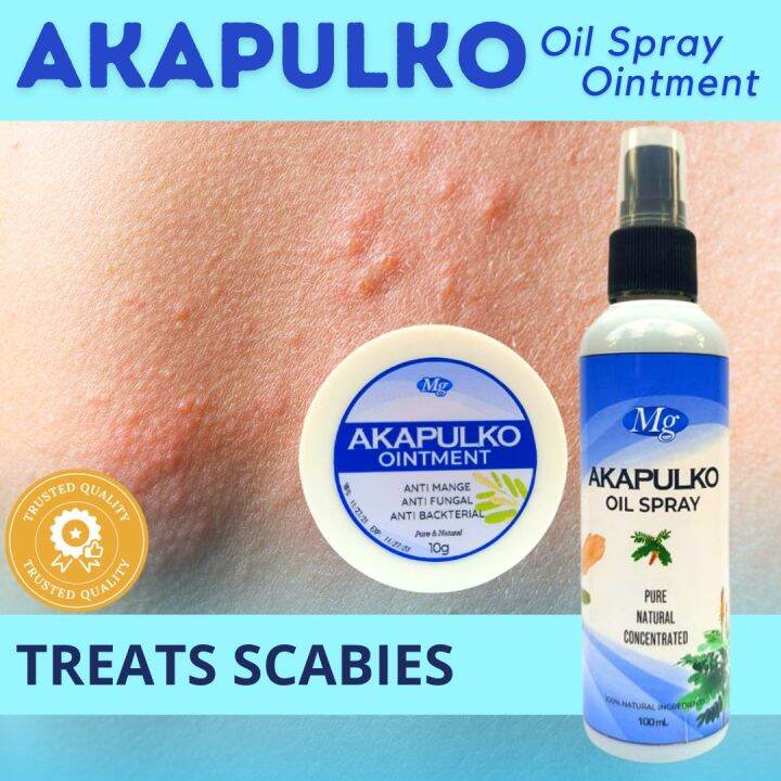 MG AKAPULKO OIL SPRAY 100ML & OINTMENT 10G Anti-Rashes Herbal Cream ...