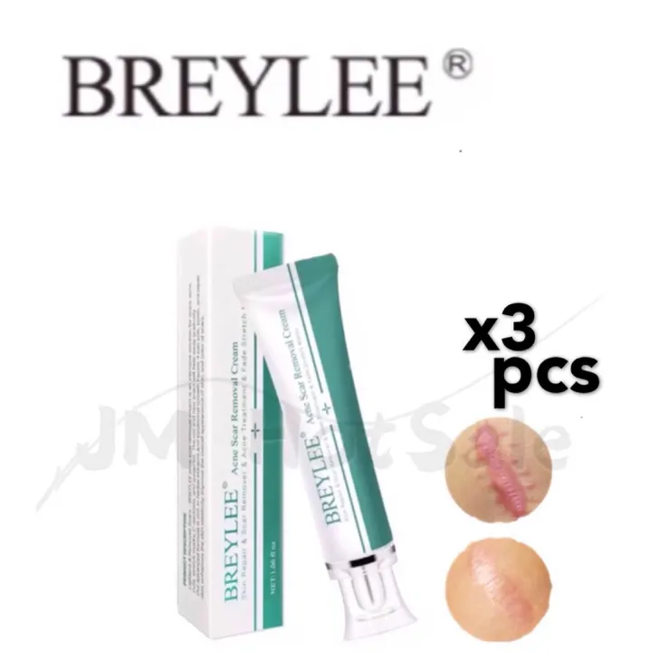 (3pcs) BREYLEE Acne Scar Removal Cream 30g Face Cream Skin Repair Skin Care Scar Acne Treatment ...