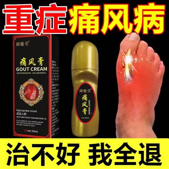 [Gout Special Effects] Ancestral Secret Recipe Gout Effect Ointment ...