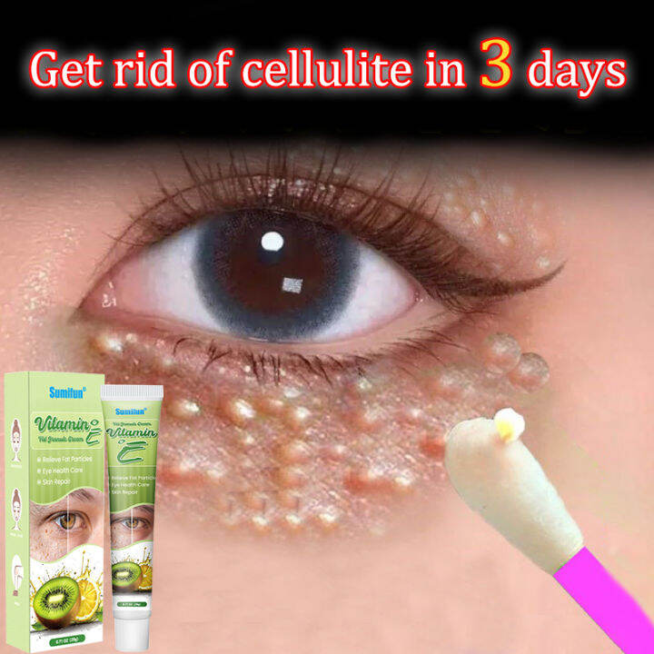 Vitamin E Fat granule Flat warts Grease grains Sweat tube granuies ...