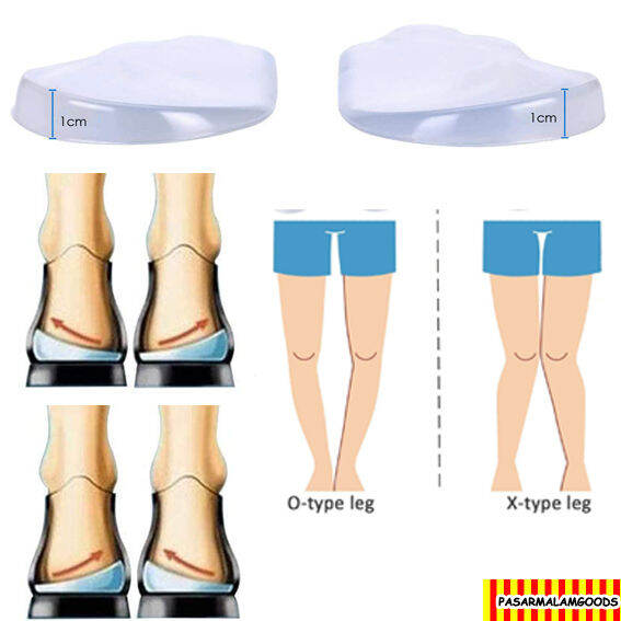 2Pair Shoe Inserts for O/X Type Leg Corrective Foot Alignment Knock ...