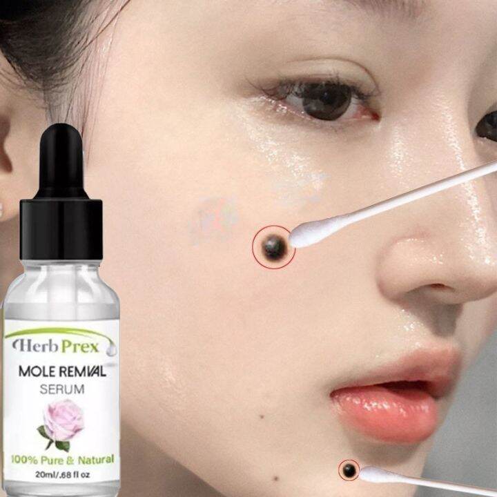 No trace Skin Tag Remover Treatment Blemish Remover Anti Wart Mole ...