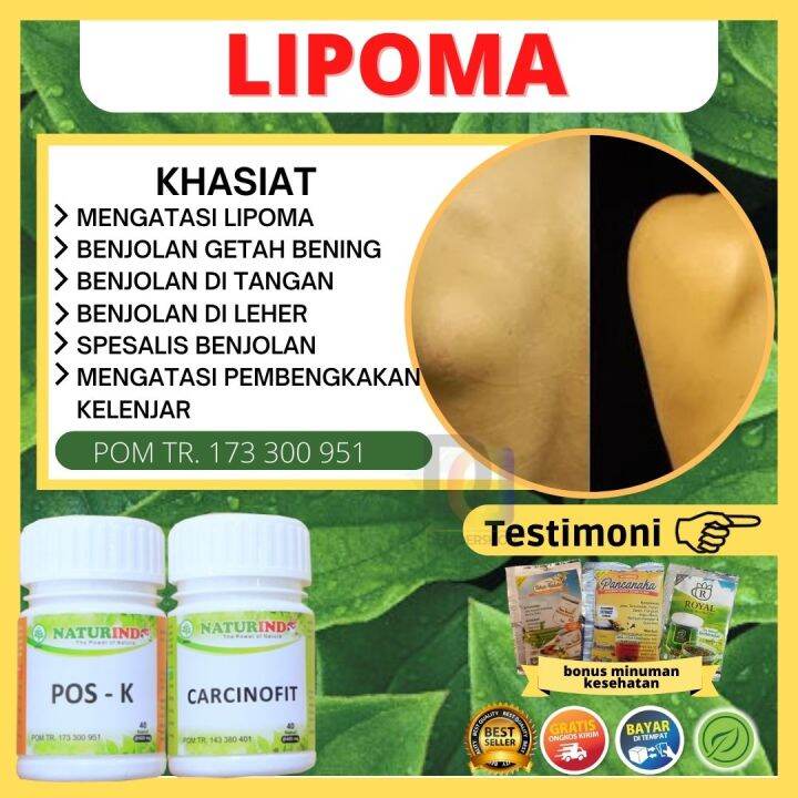 Obat benjolan lipoma penghancur lemak lipoma di tangan leher keloid ...