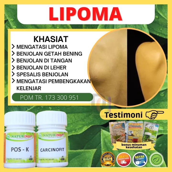 Obat benjolan lipoma penghancur lemak lipoma di tangan leher keloid ...