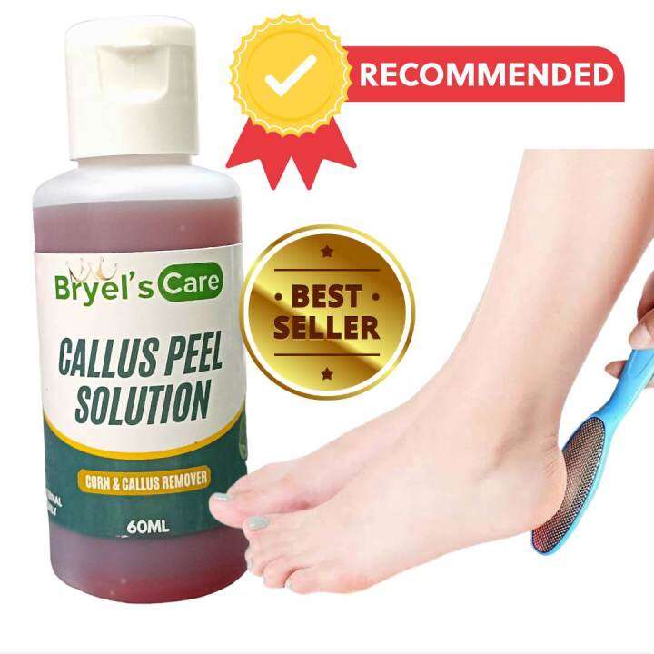 🔥 60ML CALLUS PEEL HAND AND FOOT SOLUTION/Callus Peel RemovER /Callus ...
