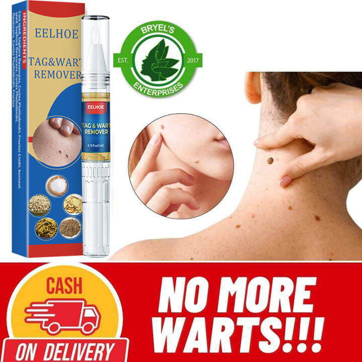 Doctor recommended Warts Remover, Skin Tags Remover, Mole Remover plant ...