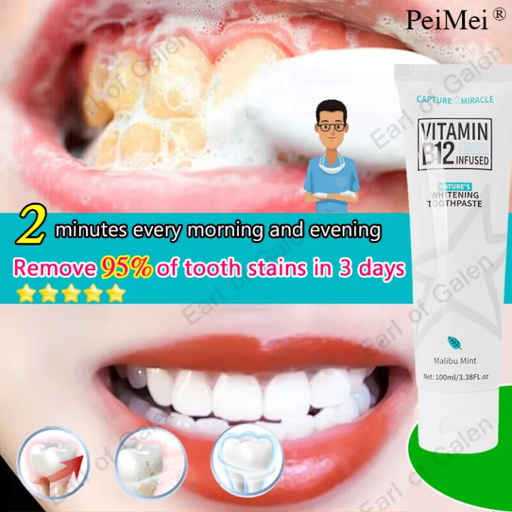 ღPrevent tooth decay PeiMei Toothpaste Vitamin B12 Infused Teeth ...