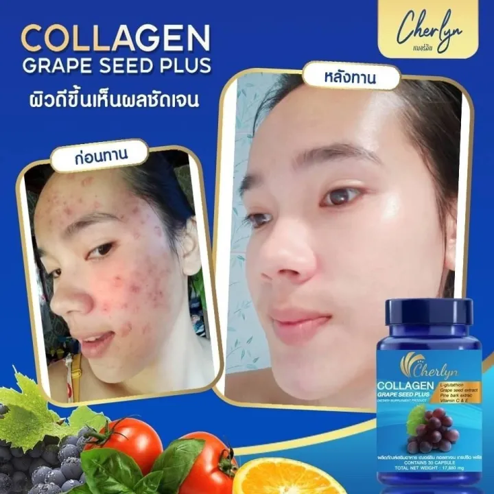 Cherlyn collagen ผลิตภัณฑ์เสริมอาหารบำรุงดูแลสุขภาพผิวพรรณ ผม เล็บ สาร ...