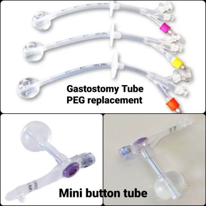 Gastrostomy Feeding Silicone 3 way tube | Lazada PH