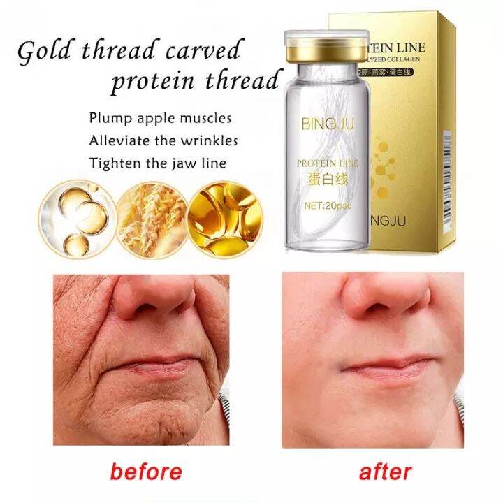Face Filler Absorbable Collagen Protein Thread Face Lift Plump Silk ...