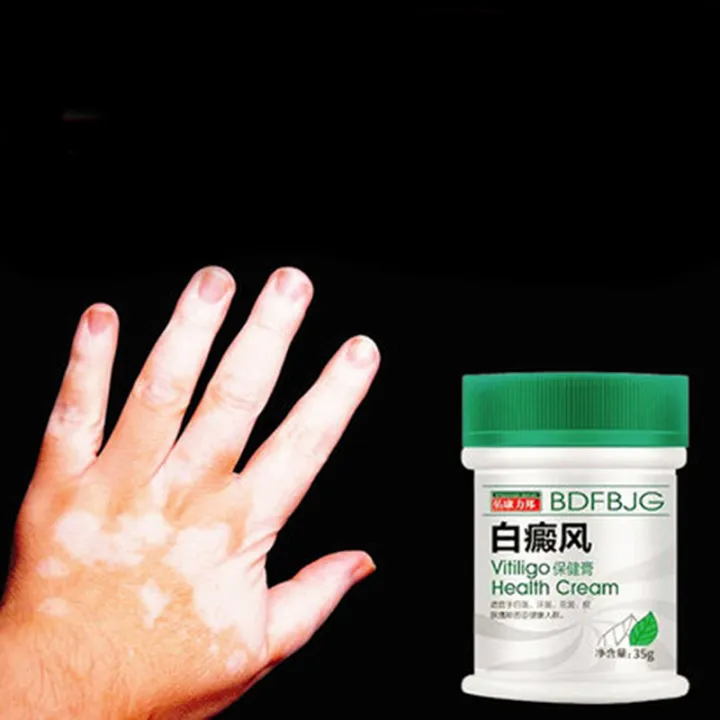 💄 BELLE 30ml Chinese Vitiligo Ointment On Face Neck Back Hands Liniment ...
