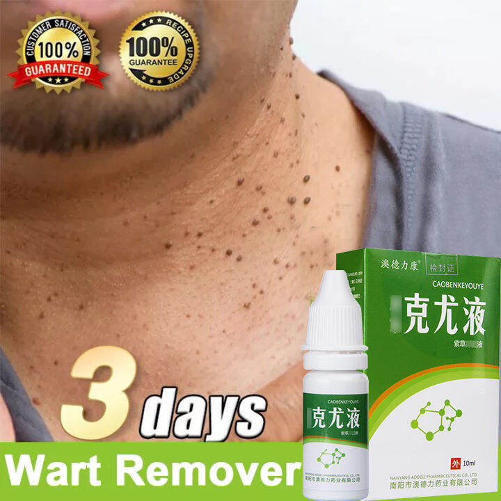 100% Original and Effective Gram Wart Liquid Fast Removal Of Flat Warts ...