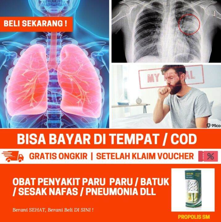 Obat Batuk Berlendir dan Gatal, Obat Alami Batuk Berdahak ...