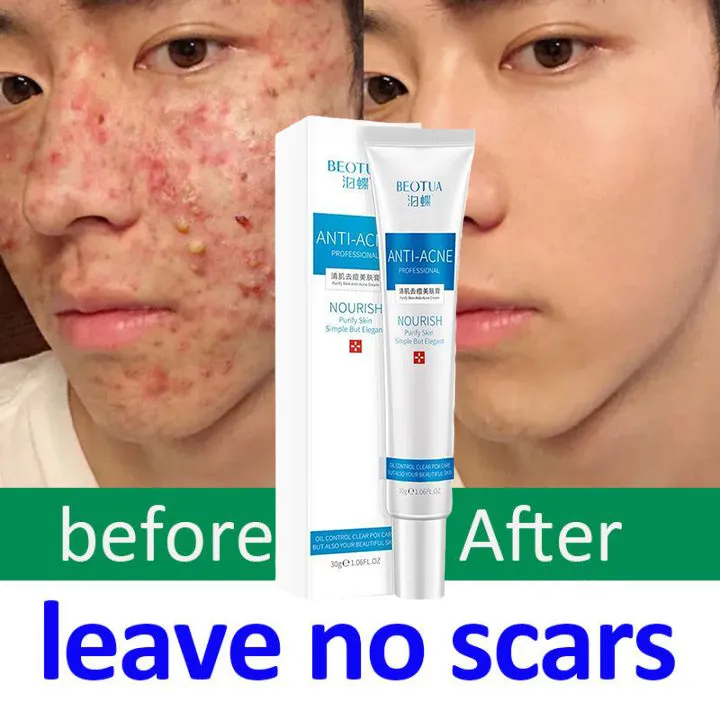 Care Shrink Pores Aloe Gelatine Bye Scar Aloe Vera Soothing Gel Skin ...