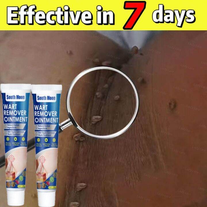 👍100% Effective 👍South Moon Warts Remover Original Warts Magic Remover ...