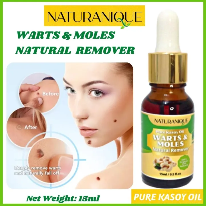 Direktang benta ng pabrika Warts Remover Pure Kasoy Oil Mole Skin Tag ...