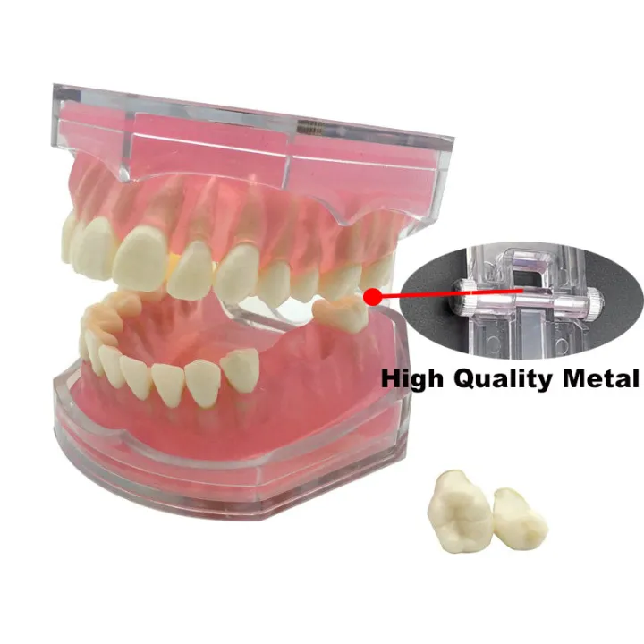 Dental Standard Model Removable Teeth Model Dentist Study Teach Model ...