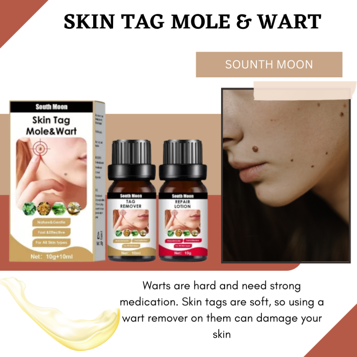 Organic Skin Tag Mole and Wart Skin Dark Spot for Callus Remover ...