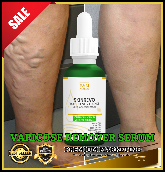 B&M PREMIERE SKINREVO VARICOSE VEIN ESSENCE SERUM ORIGINAL | Lazada PH