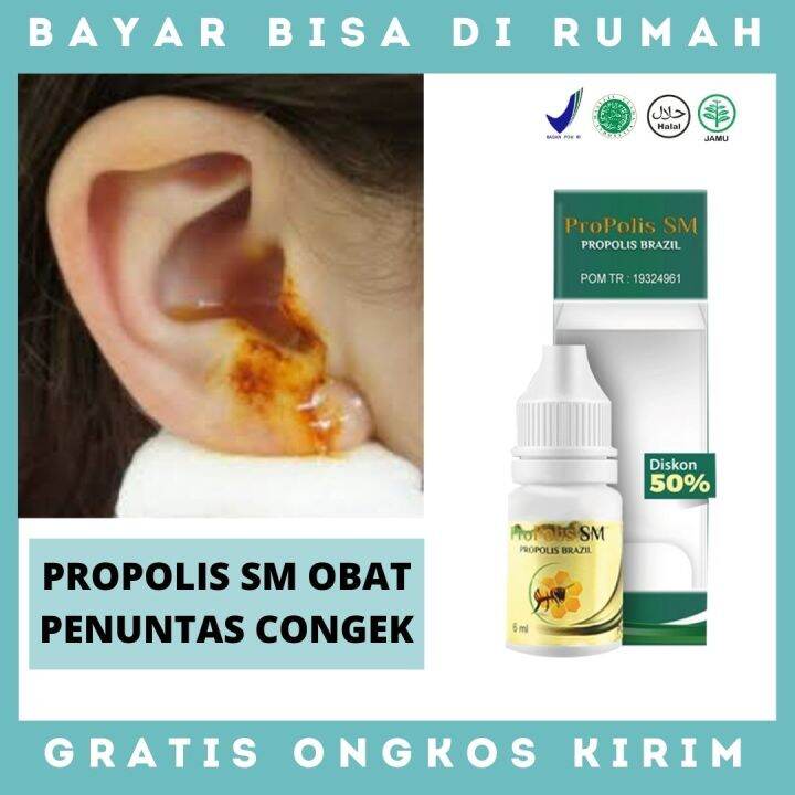 Obat Tetes congek , Obat congek anak&dewasa , Telinga Bernanah ...