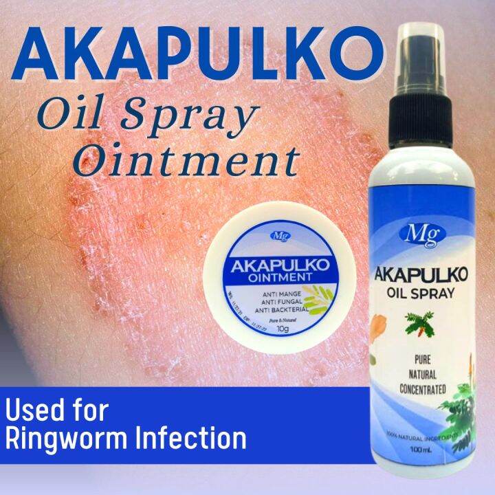MG AKAPULKO OIL SPRAY 100ML & OINTMENT 10G Anti-Itchy Skin Balm Herbal ...