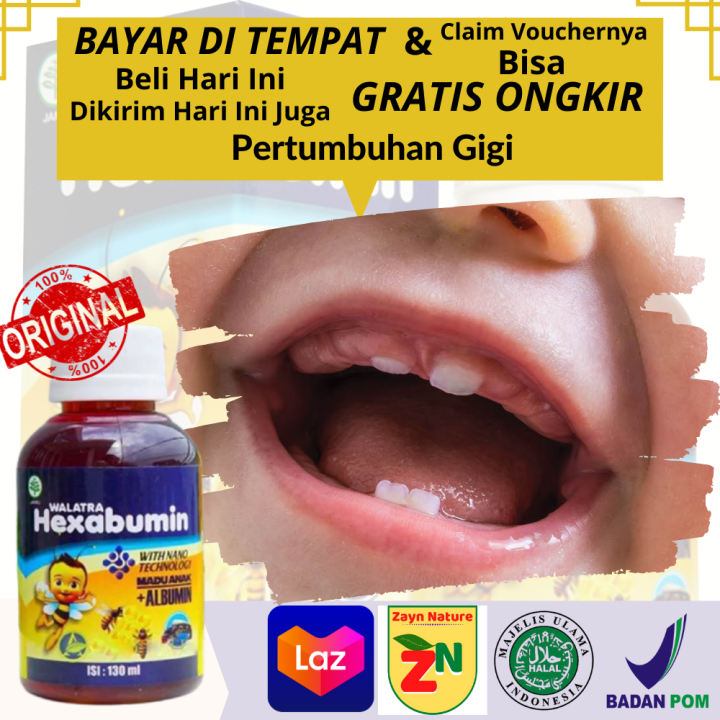 Obat Mempercepat Pertumbuhan Gigi Anak, Madu Enak Untuk Mengatasi Gigi ...