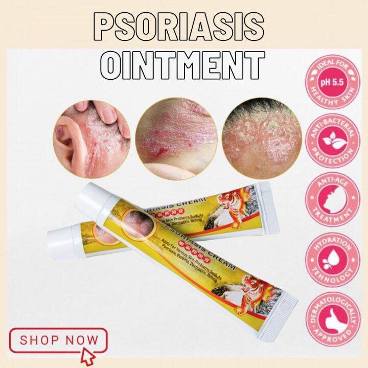 Original Psoriasis Ointment Dermatitis Eczema Tinea Itching