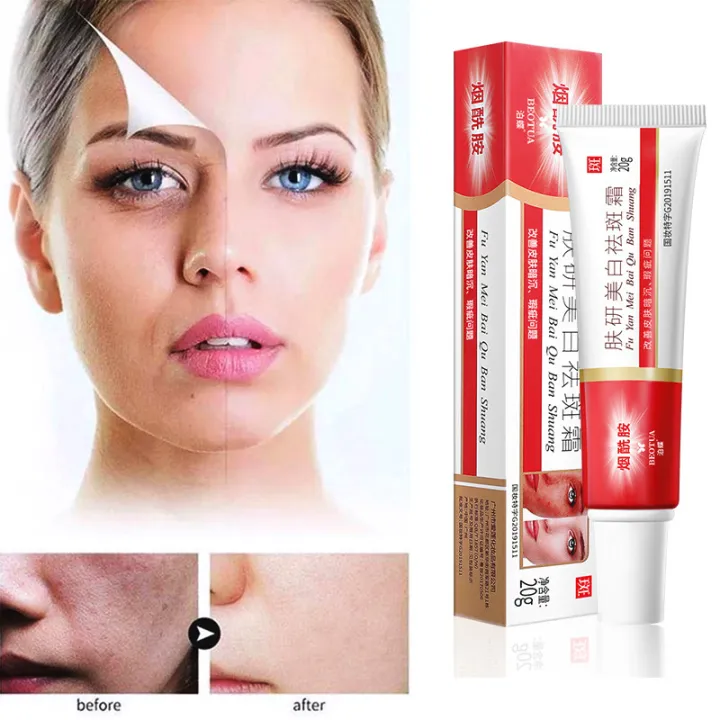 Whitening and Freckle Removing Cream,Effective Herbal Acne Black Spots Removal Cream,anti Aging ...