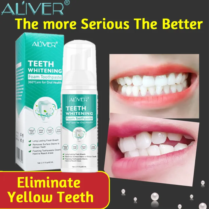 Aliver Cleaning Teeth Whitening Mousse Foam Toothpaste Oral Hygiene ...