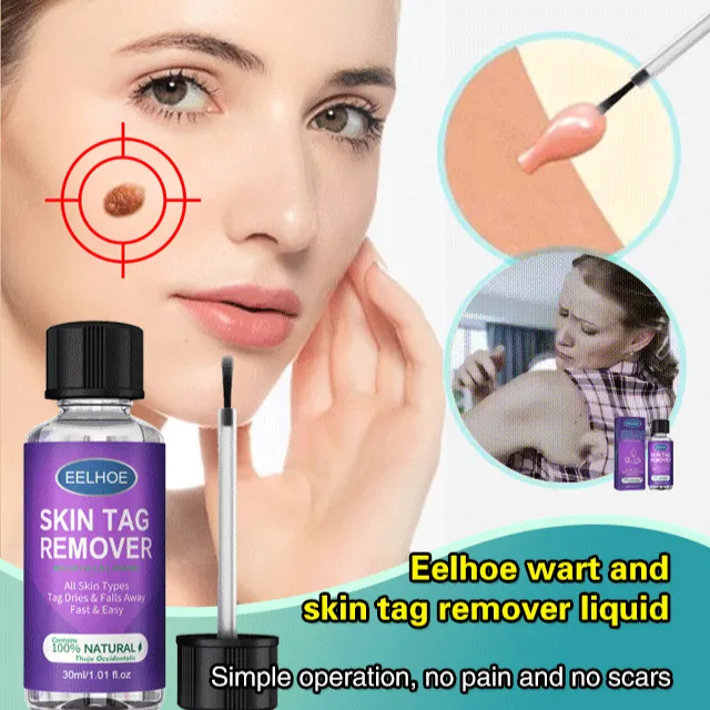 Hellofuture Eelhoe wart and skin tag remover liquid | Lazada PH