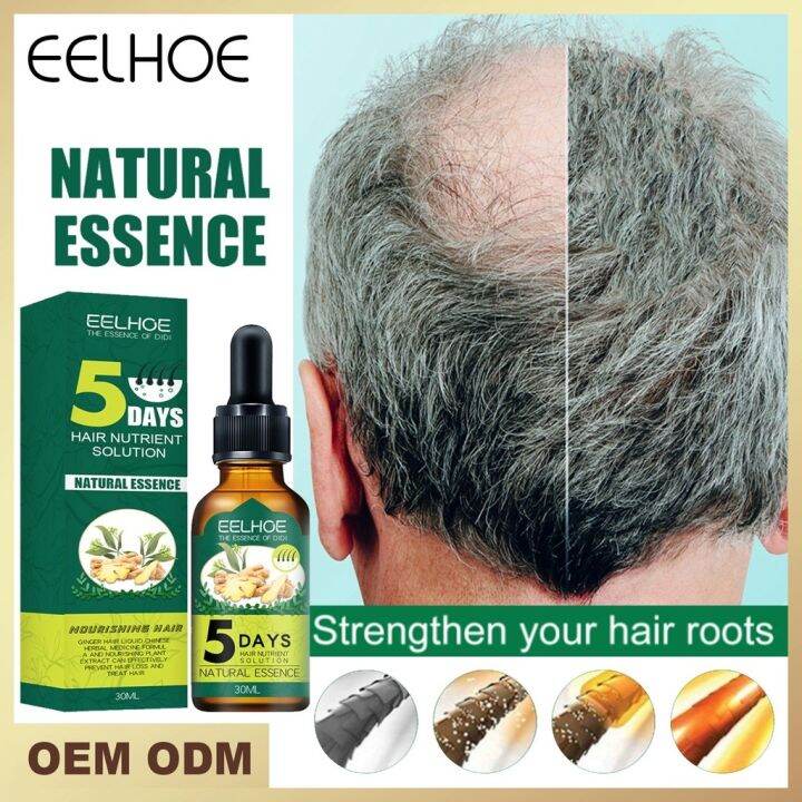 5 Days Hair Nutrient Solution Ntural Essence 30ml Lazada Ph