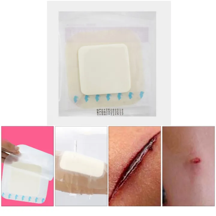 HOMEMAXS Wound Dressing Soft Safe Novel Fine Cuts Pad Bedsore Patch ...