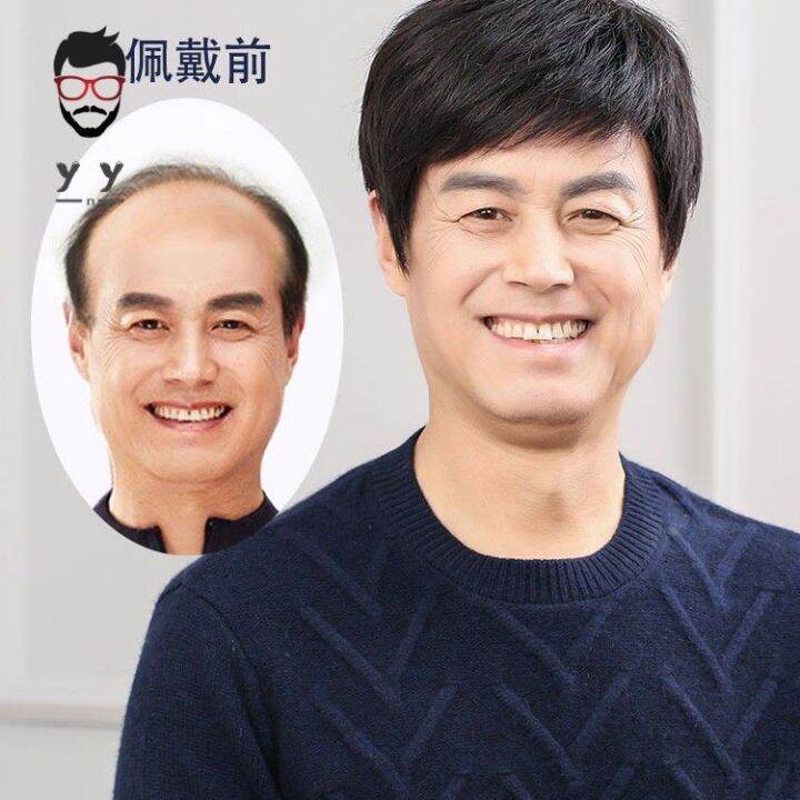 Wig Pria Rambut Pendek Pria Tampan Kepala Pengganti Potongan Setengah ...