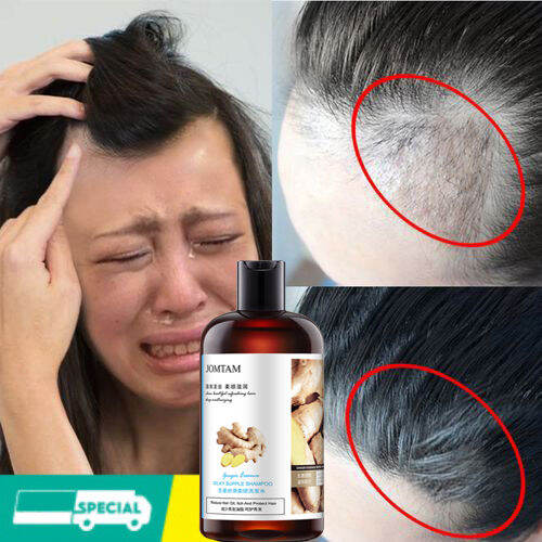 Hair Growth Anti hair loss Bald regrowth hair Anti dandruff Oil Control ... Hair Growth Anti hair loss Bald regrowth hair Anti dandruff Oil Control ...