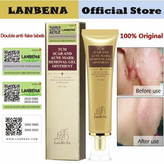 LANBENA TCM Scar Ance Mark Removal Skin Repair Cream 30ml | Lazada PH